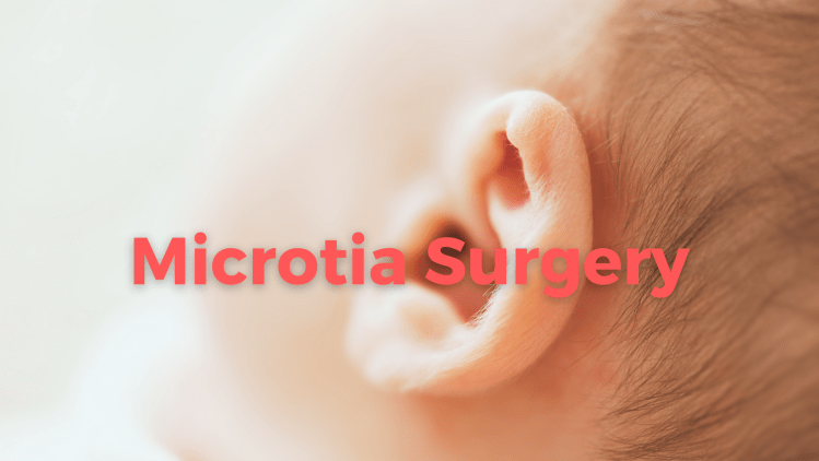 Microtia Surgery – Sister Kay McNaught